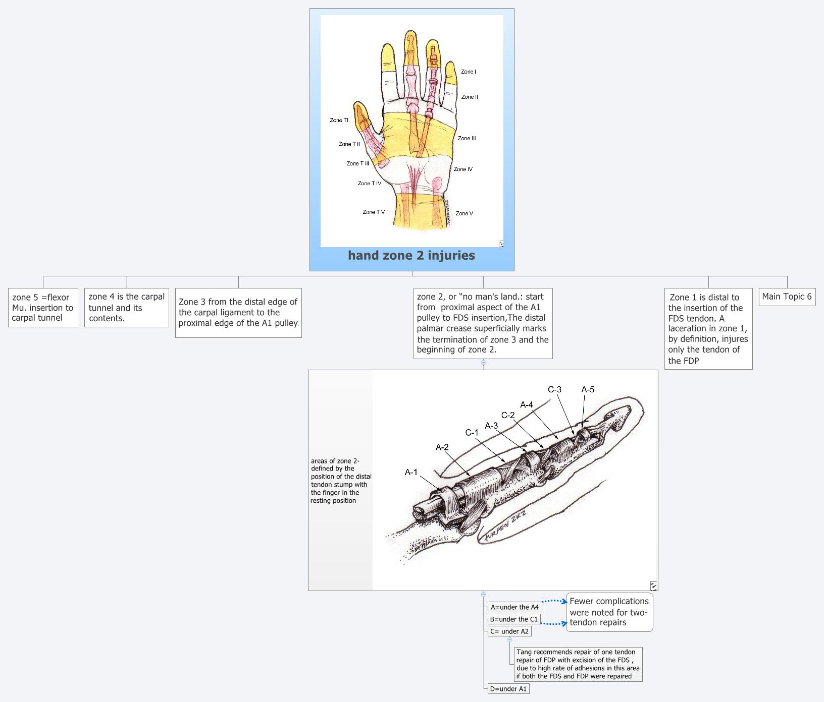 hand zone 2 injuries | Amer Almohssen - Xmind