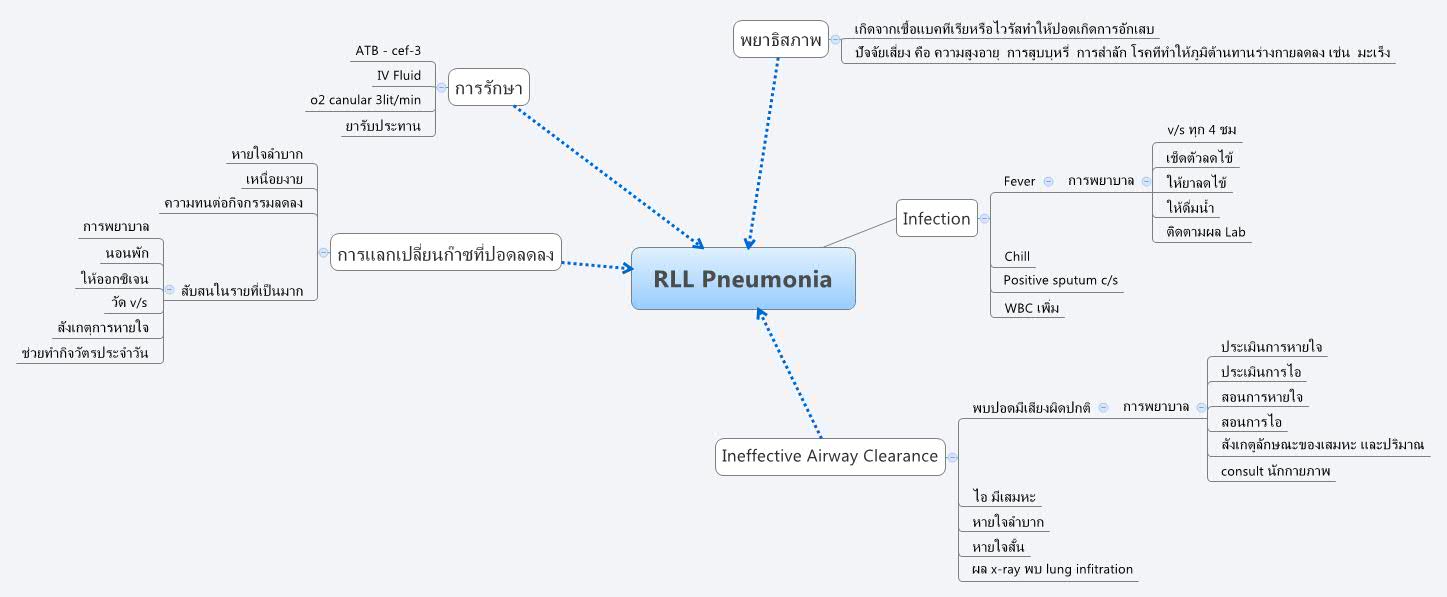 RLL Pneumonia - Xmind - Mind Mapping App