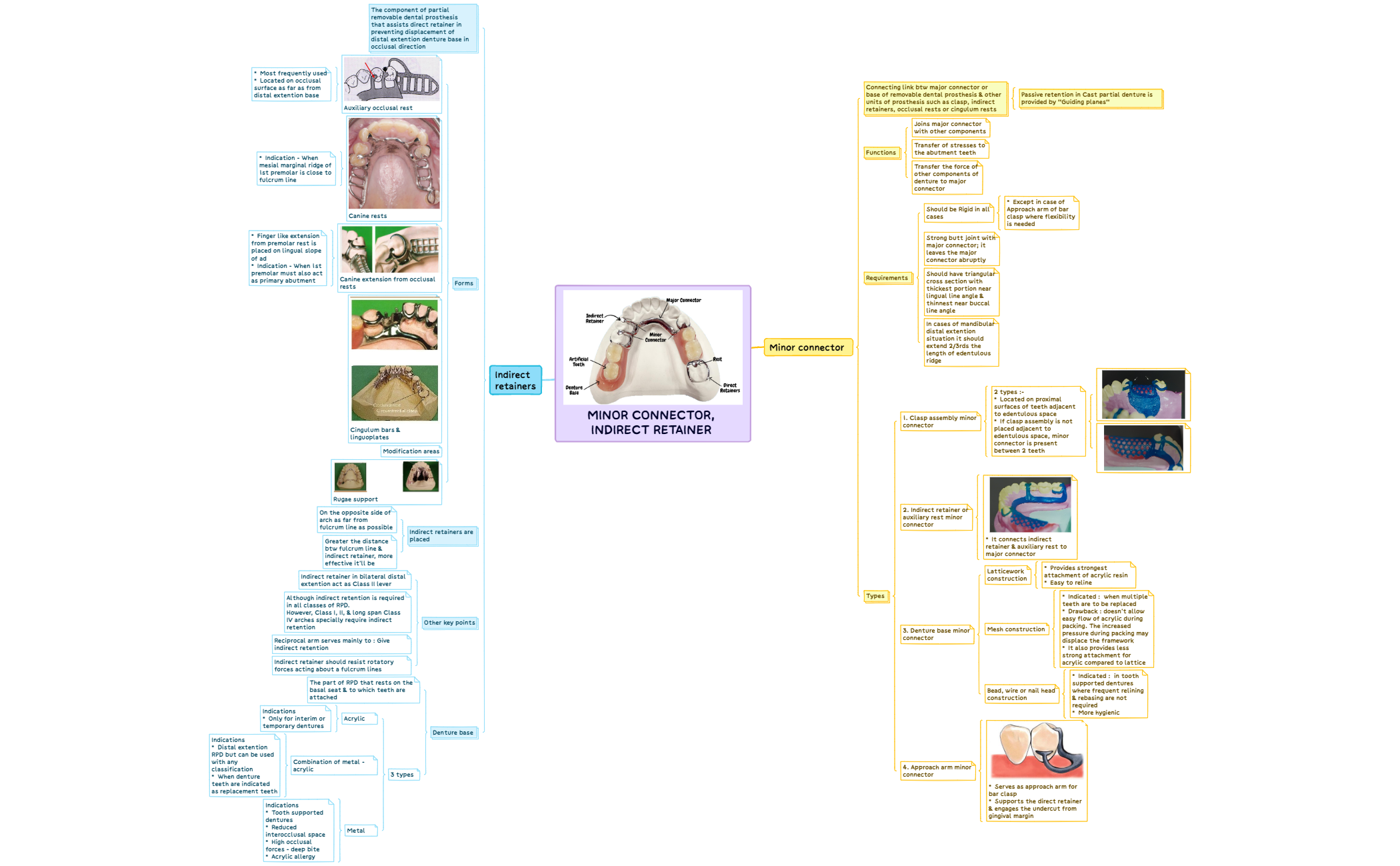 Minor connector, Indirect retainer | MARTONI DUTTA - Xmind